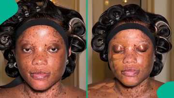Lady Shows Amazing Makeup Transformation As Artiste Covers Her Freckles ...