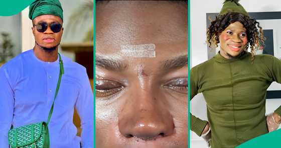 Zicsaloma Reacts to News About His Nose Surgery, Alleged Cost: "Be ...