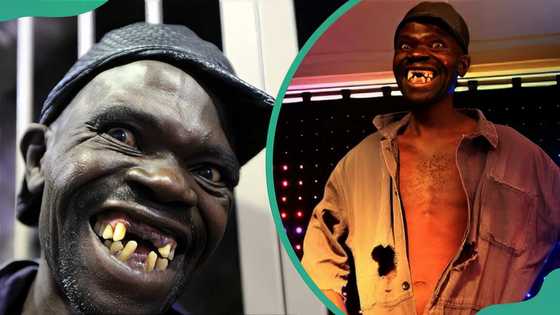 Who is the ugliest person in the world? Top 9 people with pictures ...