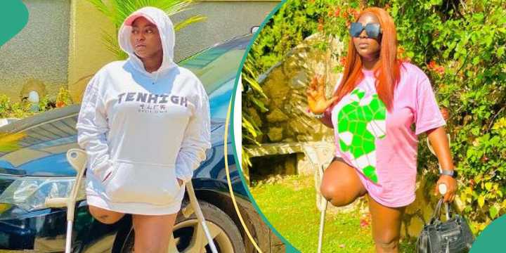 “Men Date Me Out of Pity”: Physically Challenged Actress, Doris Still ...