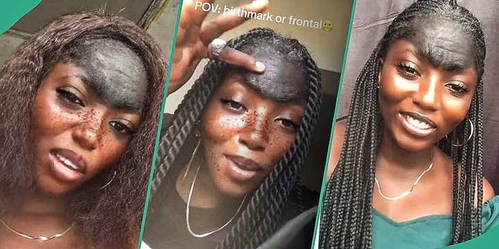 Lady Thanks God for Unique Birthmark on Her Forehead, Says It Took Her ...