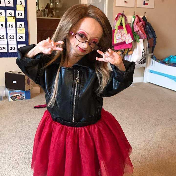 Adalia Rose bio: age, parents, condition, death rumors - Legit.ng