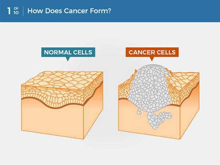 FACT-CHECK: Does Laptop/PC Radiation Cause Skin Cancer & Infertility ...